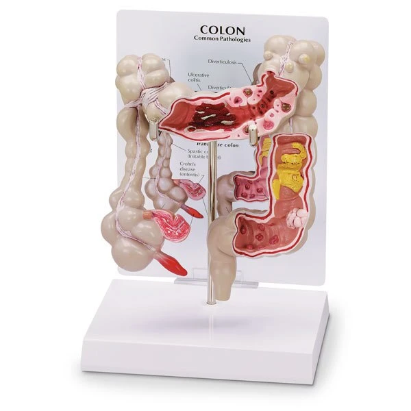 Buy Colon Model for Anatomy Training | LivCor